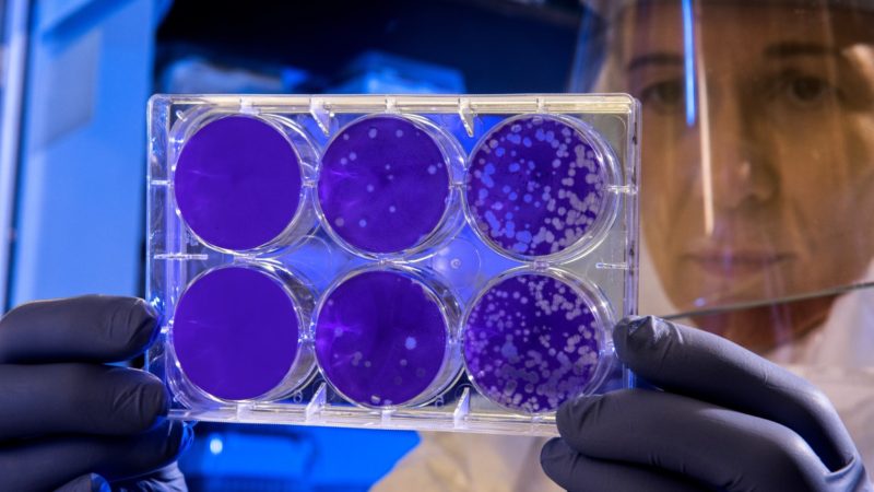 Do Bacteria Glow In The Dark? | Rectofossal Ambiguity